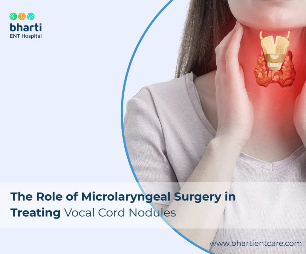 The Role of Microlaryngeal Surgery in Treating Vocal Cord Nodules